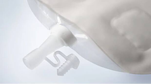 Wat is een urinestoma?